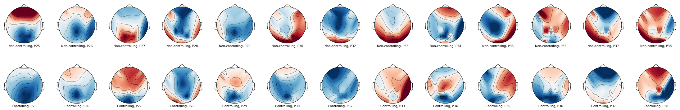 Classification Of Eeg Data Mokhles Bouzaiens Blog